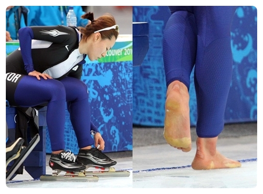 김연아 발 박지성 발 강수진 발 고통과 인내의 시간을 말해주다 네이버 블로그