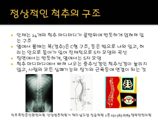 안양척추측만증전문한의원 척추측만증의 이해와 척추측만증의 종류 안양척추측만증전문한의원 네이버 블로그