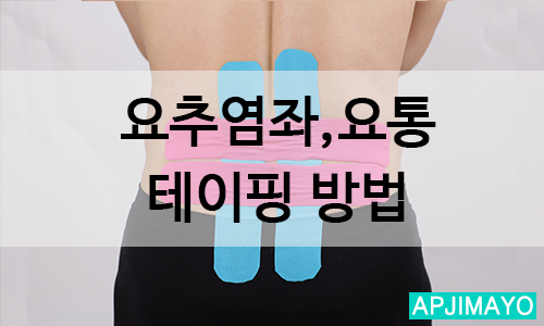 허리통증테이핑방법 허리통증의 요추염좌테이핑 And 요통테이핑 네이버 블로그