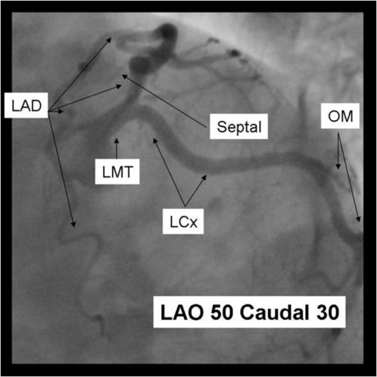 CAG 보는 방법 : 네이버 블로그