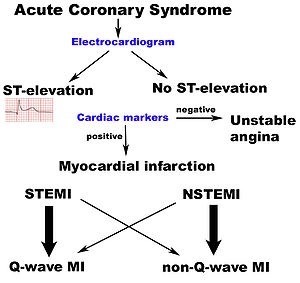 NSTEMI vs. STEMI : 네이버 블로그