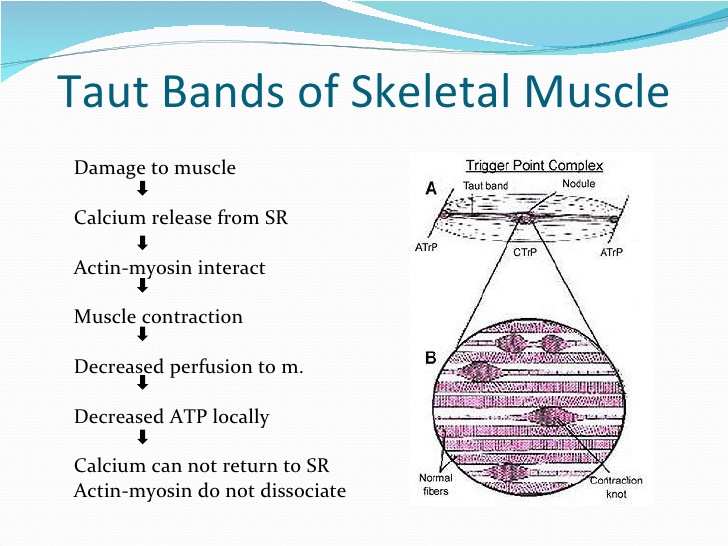 잘 낫지 않는 팔꿈치 통증, 테니스엘보우(외측상과염)의 이유 및 치료법 -노원 팔팔한의원 : 네이버 블로그